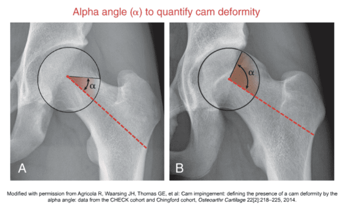 Hip and Groin pain - Advanced Clinical Education Educating, mentoring ...