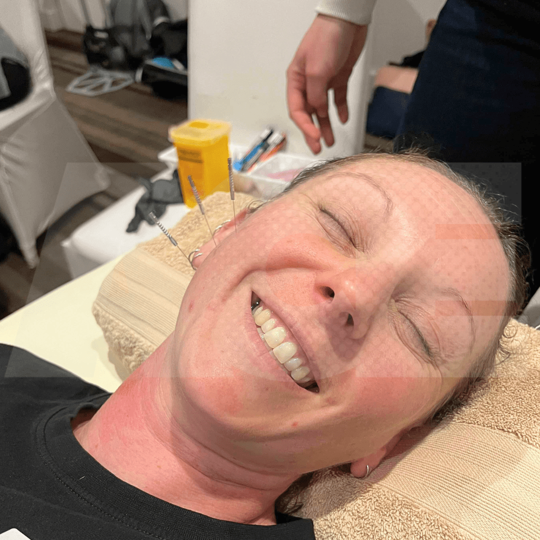 Dry Needling Course | Advanced Clinical Education