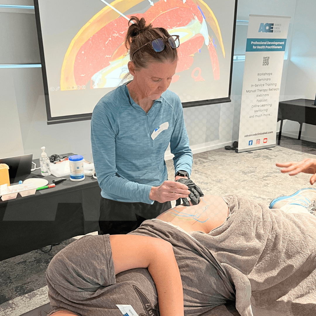 Dry Needling Course | Advanced Clinical Education